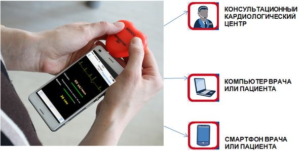 АВ-узловая реципрокная тахикардия (АВУРТ): причины, симптомы и лечение ...